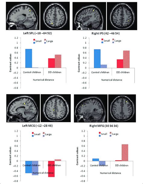 Localization Of Brain Areas Showing More Activation For Control