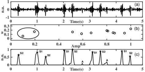 Heart Sounds Segmentation And Classification With Artifacts A Download Scientific Diagram