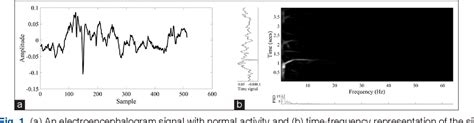 Figure 1 From The State Of The Art In Feature Extraction Methods For Electroencephalogram