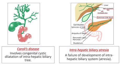Development Of Liver Pancreas Spleen And Extrahepatic Biliary
