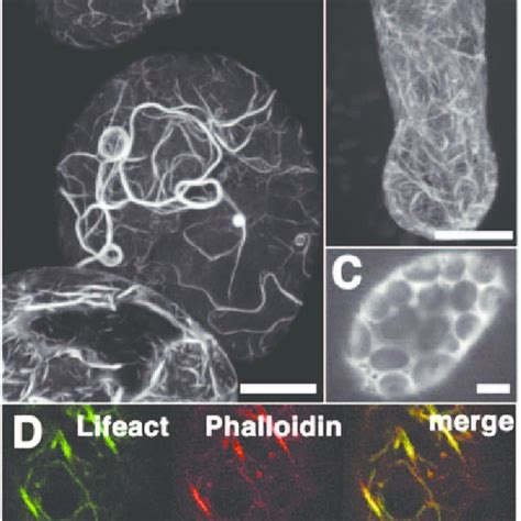Actin Fi Laments In M Polymorpha Visualized By Lifeactvenus A