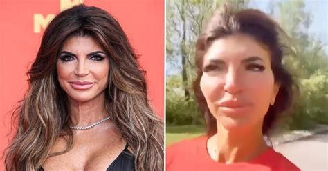 Megan Lee Plastic Surgery