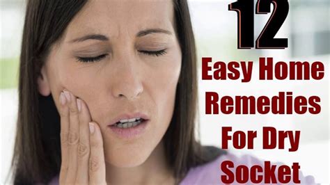 What Is A Dry Socket Diagnosis And Management Youtube