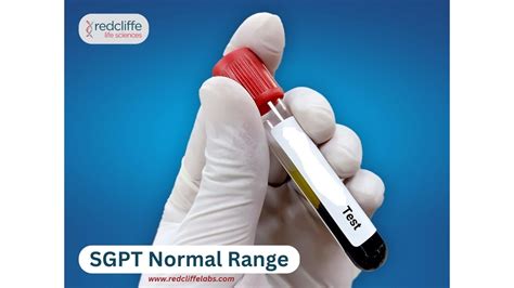 Sgpt Normal Range Redcliffe Labs By Danish Issuu