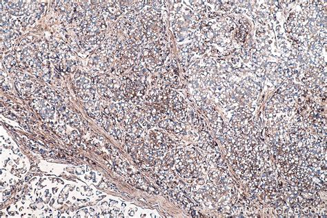 Biglycan Antibody 67275 1 Ig Proteintech