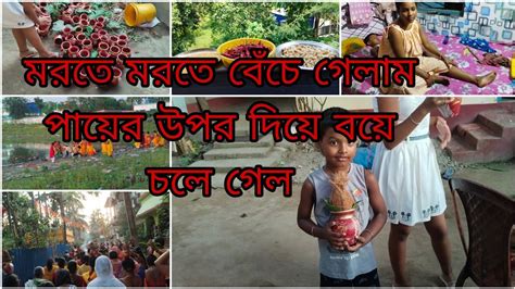 অনেক বড় একসিডেন্ট হয়ে গেল মরতে মরতে বেঁচে গেলামপায়ের উপর দিয়ে