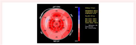 Strain Analysis Ruled Out Cardiac Amyloidosis Download Scientific Diagram