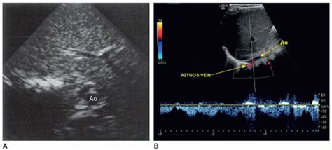 The Pediatric Abdomen Radiology Key