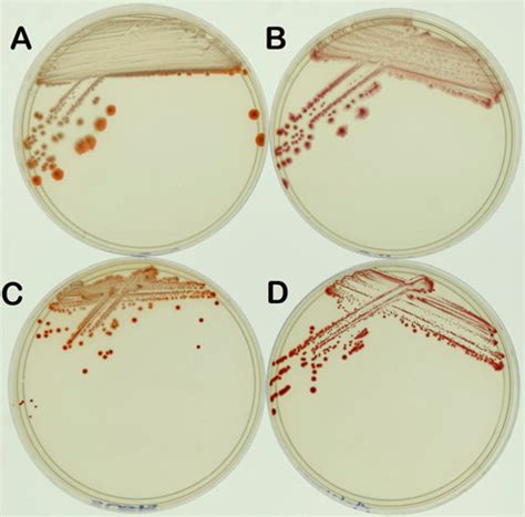 Acinetobacter On Blood Agar