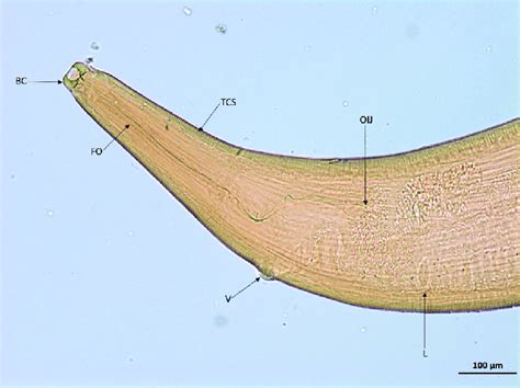 Light Micrograph Of Female Thelazia Callipaeda Anterior Bc Buccal