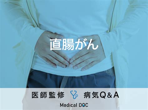 直腸がんになると現れる初期症状や原因はご存知ですかステージについても解説 メディカルドック