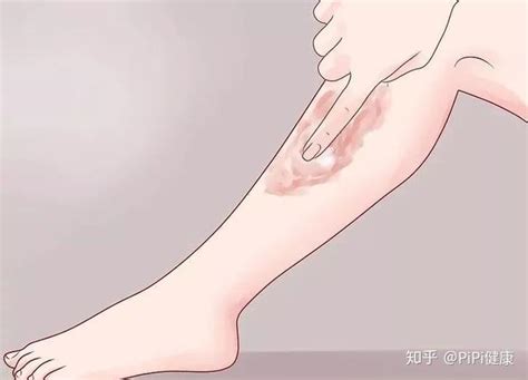 每天都洗澡，为什么身上还能搓出“泥”？可能跟这5个因素有关 知乎