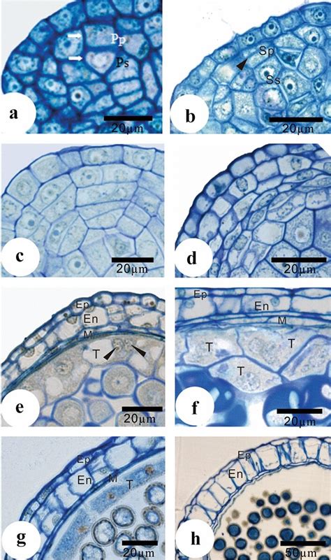Anther Wall Development In Sinomenium Acutum A Transverse Section Of A