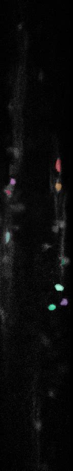Segmentation Counting Cells In 3d Image Analysis Image Sc Forum