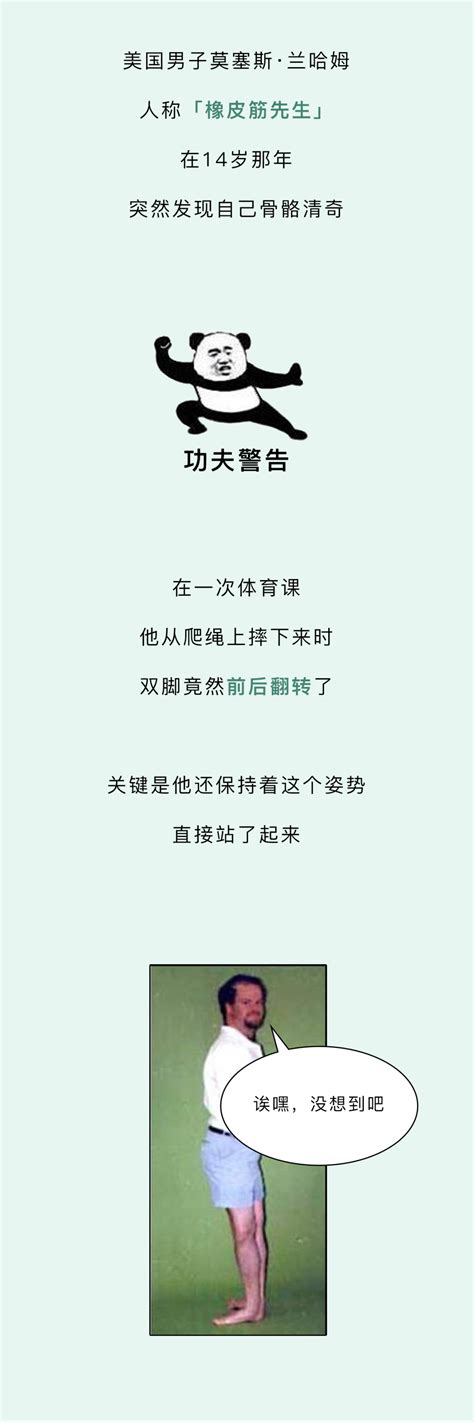 人类史上有哪些真实又离谱的超能力？百科ta说