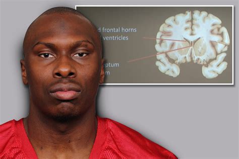 Phillip Adams Suffered From Severe Cte Similar To Aaron Hernandez