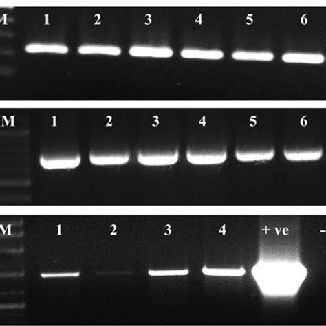 Pcr Analysis And Expression Of Gfp In Transformed C Vulgaris Gfp