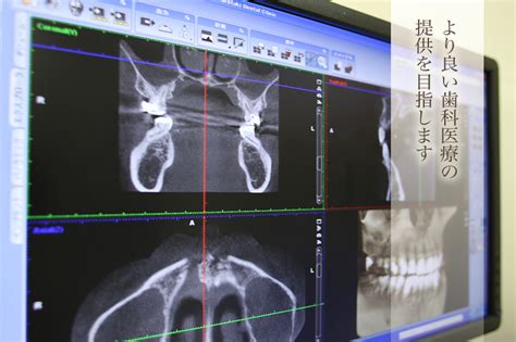 総合歯科診療黒滝歯科柏市向原の歯医者予防衛生士