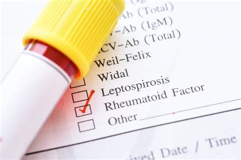 What Elevated Rheumatoid Factor Levels Mean For Your Health
