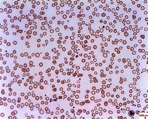 Eritropoyesis Qué Es Etapas Y Características Regulación