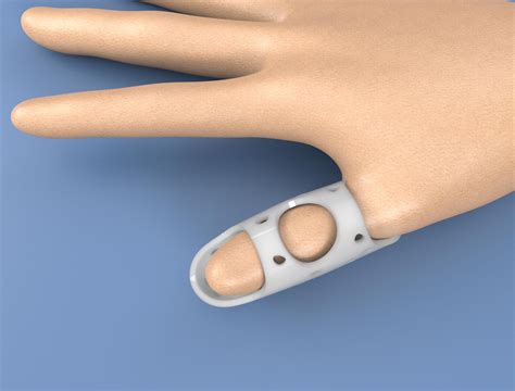 3d Finger Splint Stl Textured Brace Design For Diy Projects Customizable Finger Support For