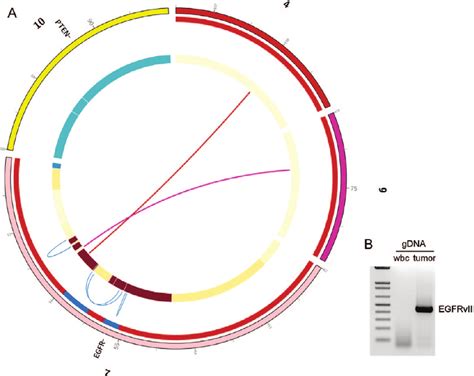 The Tumour From Patient 7 Contains An Amplification Of The Egfrviii