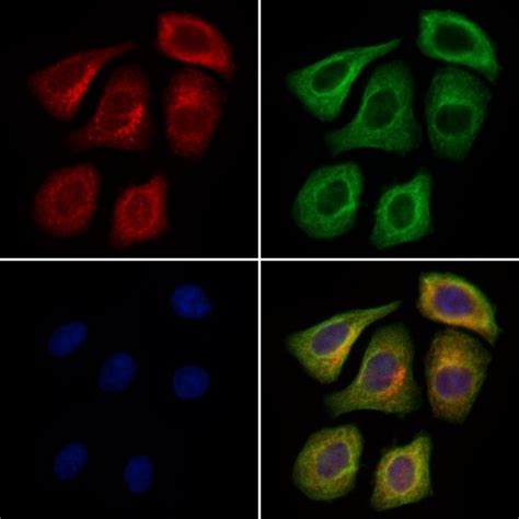 Fibrillin 1 Antibody Pa5 99225