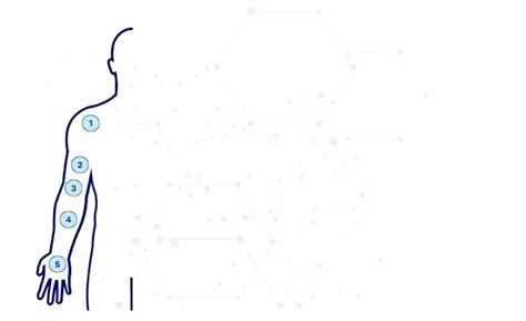 Defining Amputation Levels