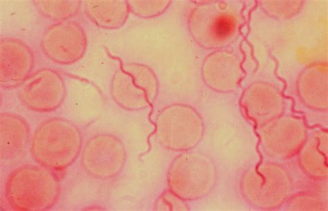 Microbiology Infection Control Flashcards Quizlet