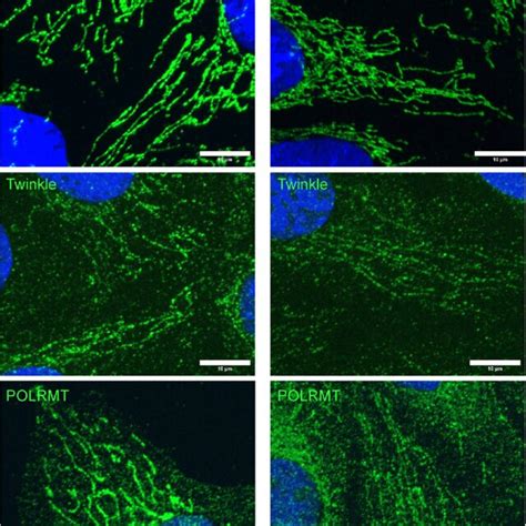 Fig S5 Nucleoid Associated Proteins And Rna Granules Before And After