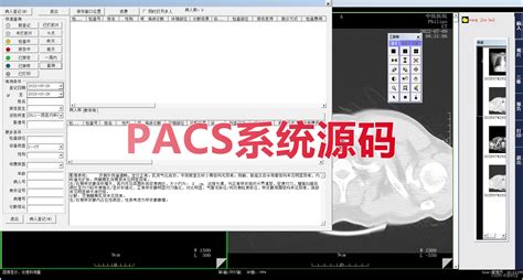 C语言c S架构pacs影像归档和通信系统源码 医院pacs系统源码
