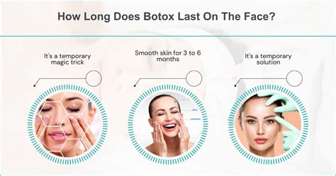 Botox On Face Rejuvenate Your Appearance 2025