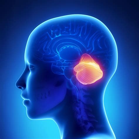 Autism Breakthrough Cerebellar Abnormalities Linked To Emotional And
