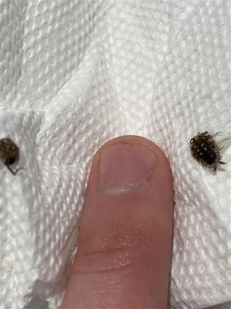 Bug Split After Killed Any Idea Calgary Alberta Canada Do I Have