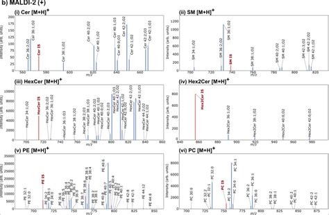 Extracted Orbitrap Mass Spectra Averaged Over Entire Mouse Brain Tissue Download Scientific Extracted Orbitrap Mass Spectra Averaged Over Entire Mouse Brain Tissue Download Scientific