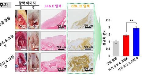 줄기세포 탑재한 초소형 로봇으로 손상된 무릎연골 재생