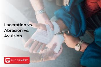 Laceration Vs Abrasion Vs Avulsion