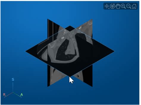 Display Labeled Medical Image Volume In Patient Coordinate System Matlab And Simulink