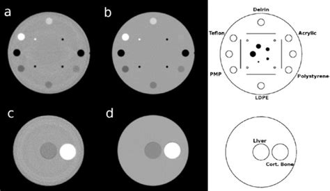 Proton Ct Or Dual Energy X Ray Ct Which Wins Out For Proton Planning