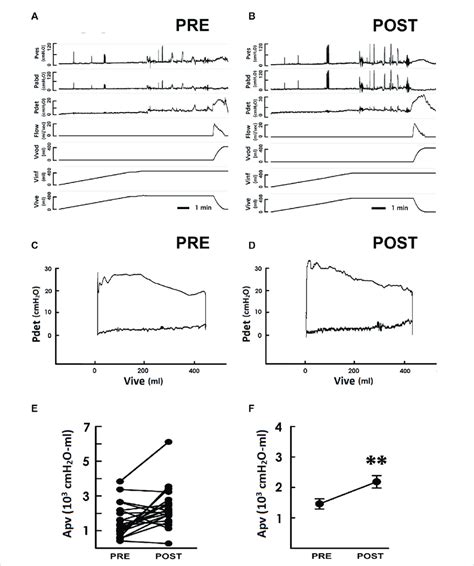 Pressure Flow Volume Analyses In Response To The TOT Surgery A B Download Scientific