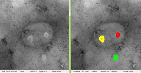 Tem Exosomeanalyzer Biii