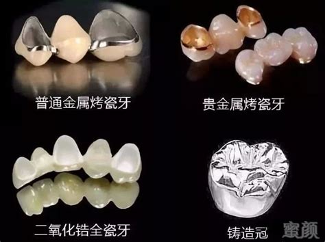 学做烤瓷牙学校做烤瓷牙技术哪里学培训学校大山谷图库