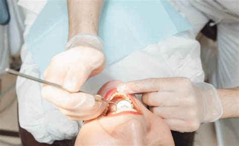 Root Canal Therapy Kenmore Wa Kenmore Dental