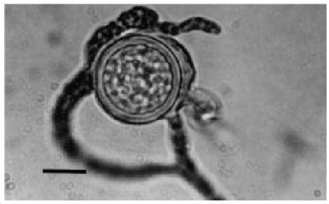 Aplerotic Oospore Of Pythium Sulcatum Showing Characteristic Furrowed