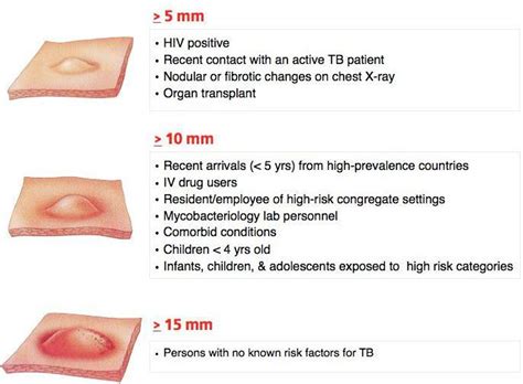 Classification Of The Ppd Tuberculin Skin Test Reaction Medizzy