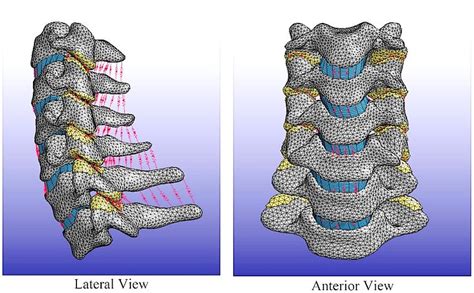 Finite Element Model Of Cervical Spine 25 Download Scientific Diagram