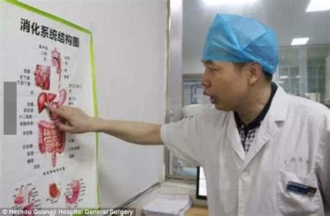 她忙碌到幾乎不吃早餐腹痛到醫院竟被取出這麼多結石 每日頭條