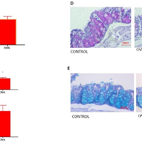 Allergic Airway Inflammation Analysis In Mice A The Total Number Of