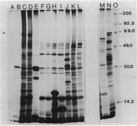 Fluorogram Of L 35s Methionine Labeled Polypeptides From An In Vitro