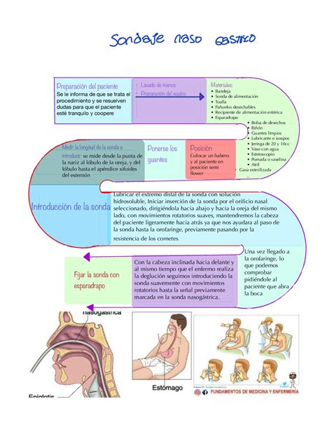 Sonda Nasogastrica Infografia Apuntes De Estructuras Y Procedimientos